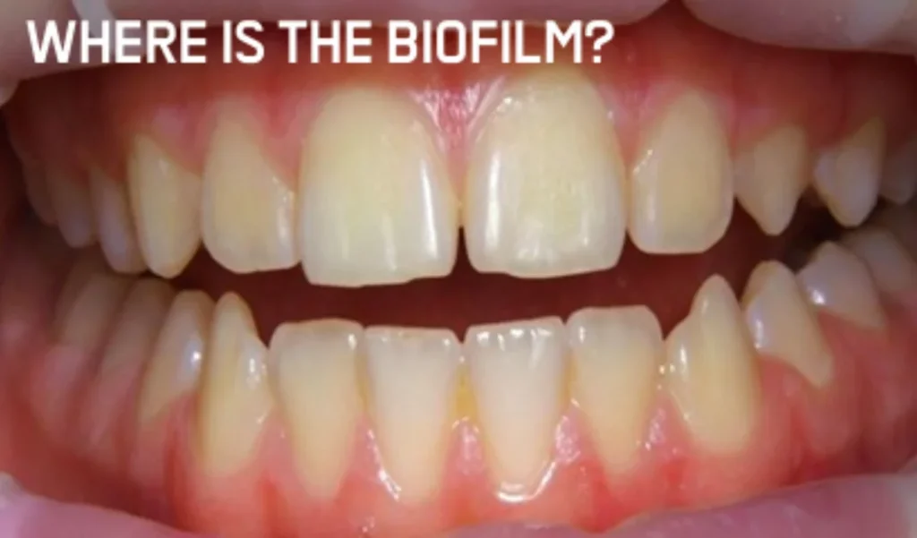 GBT Air Flow | vertexdentalthailand.com